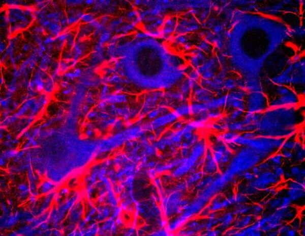 Anti-Microtubule-Associated Protein 2 (MAP2) Antibody | AB5622